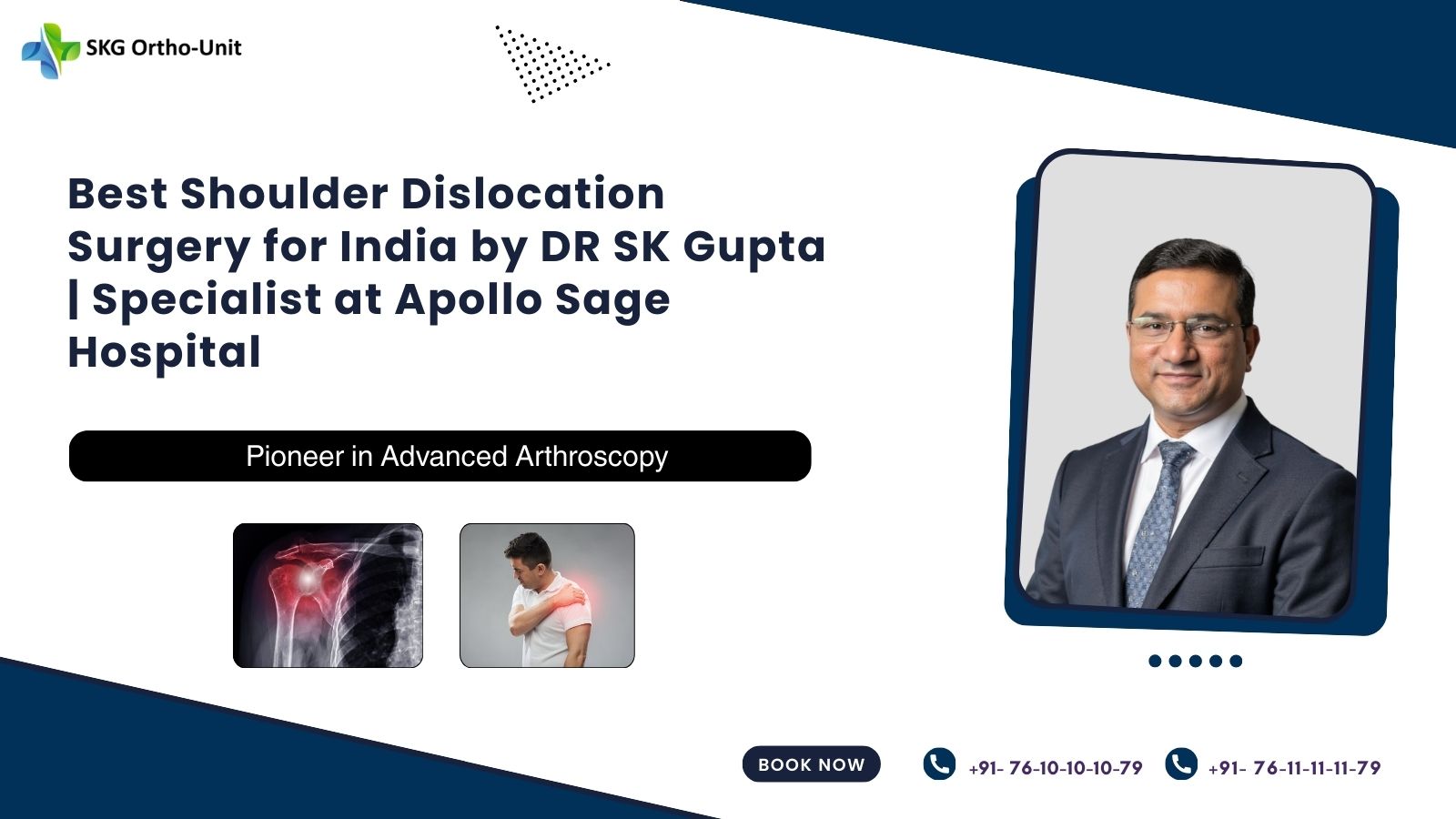 Best Shoulder Dislocation Surgery For India By DR SK Gupta